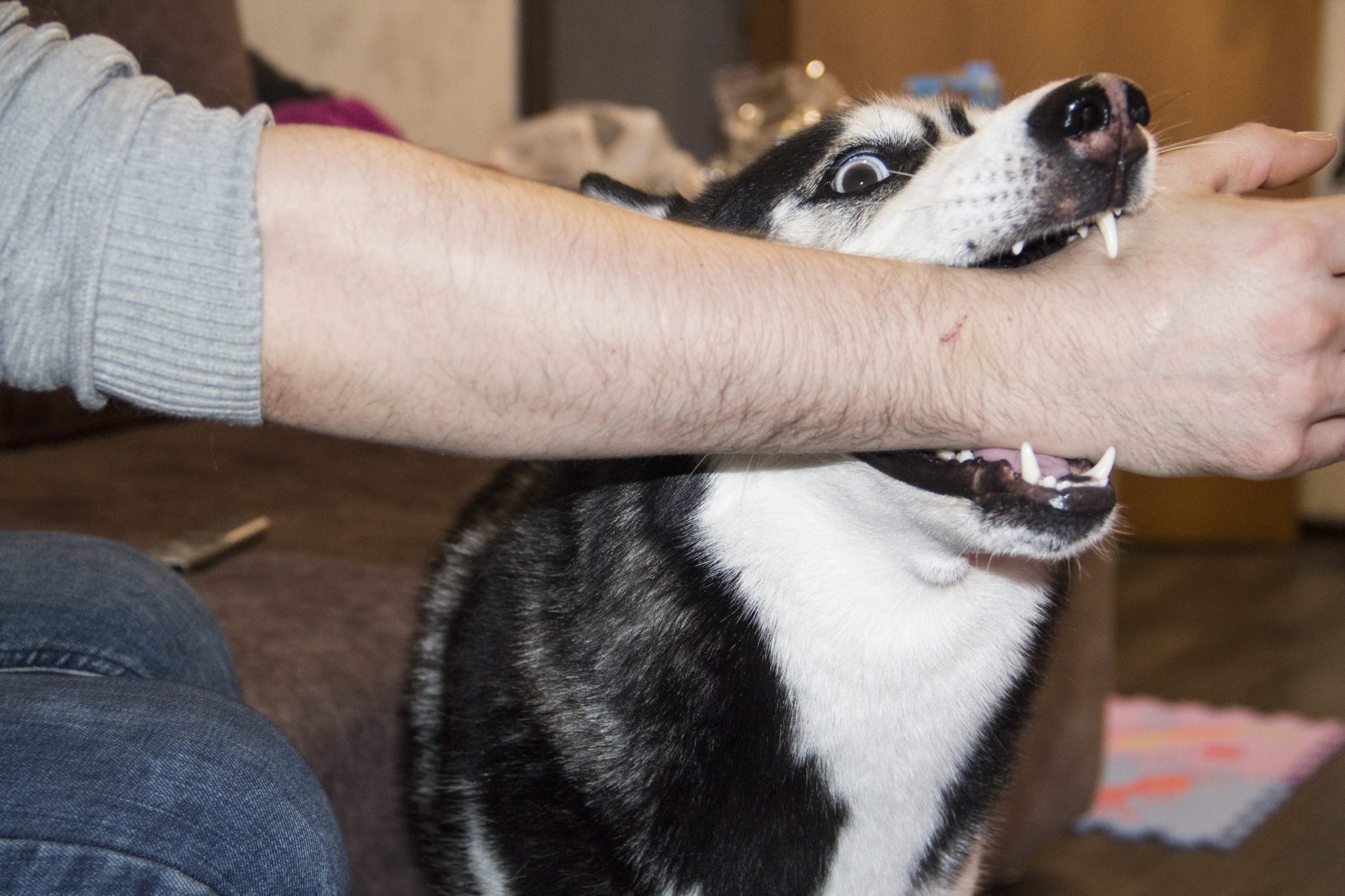 Washington’s Dog Bite Laws – Strict Liability Rules and Common Defenses